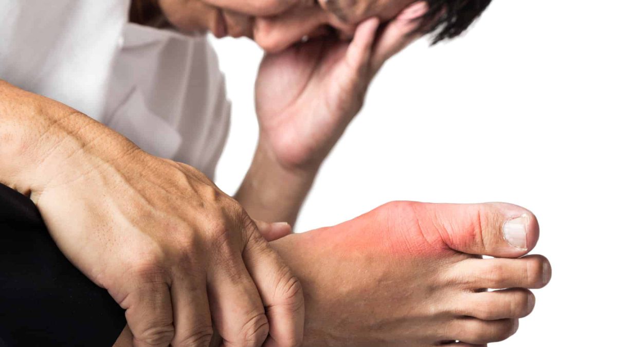 Gout Relief & Prevention - Seniors Guide